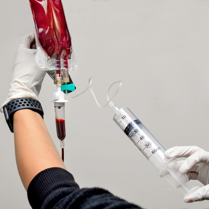 Ozone Therapy in Roanoke VA